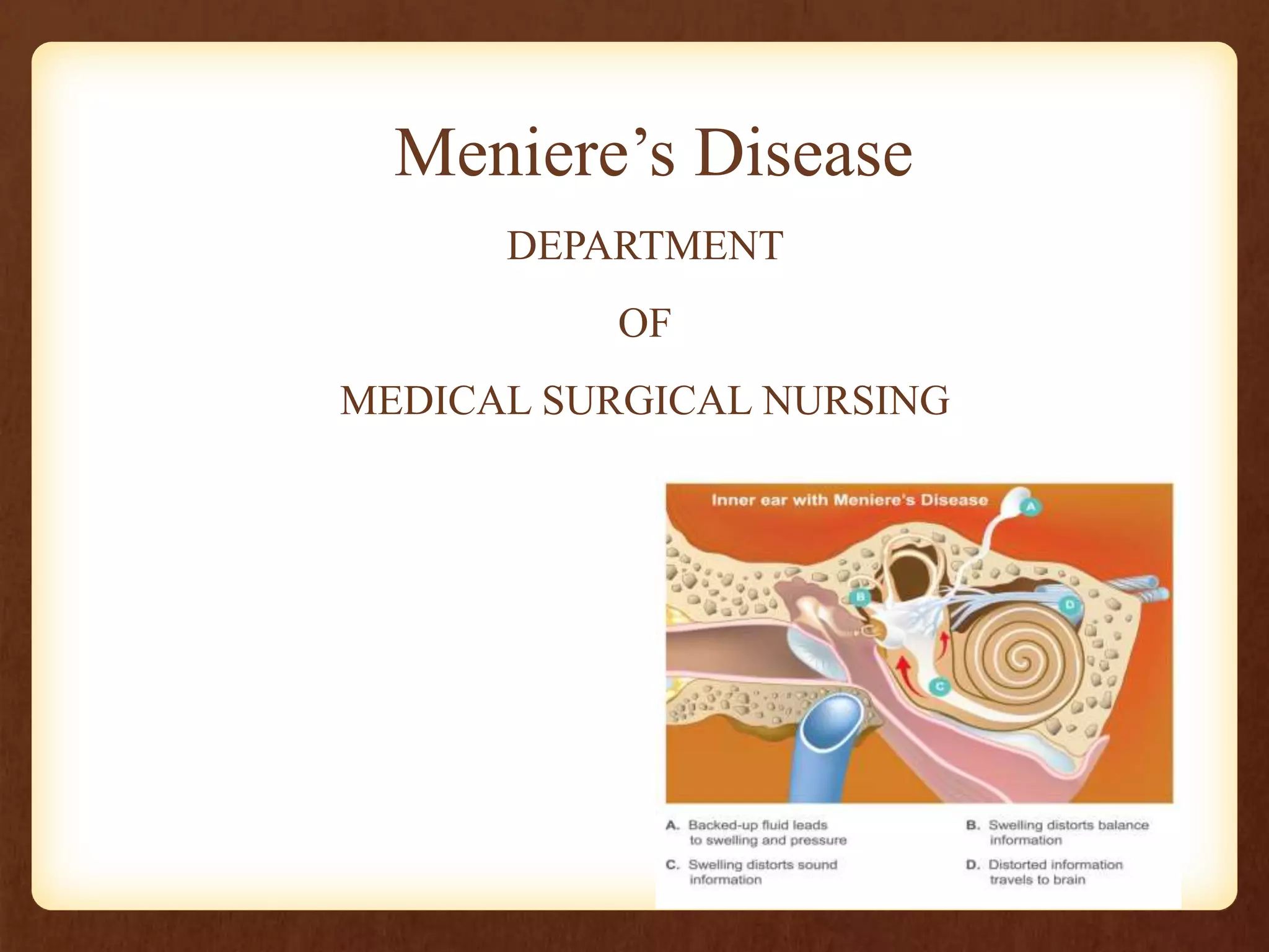 Meniere's disease | PPTX