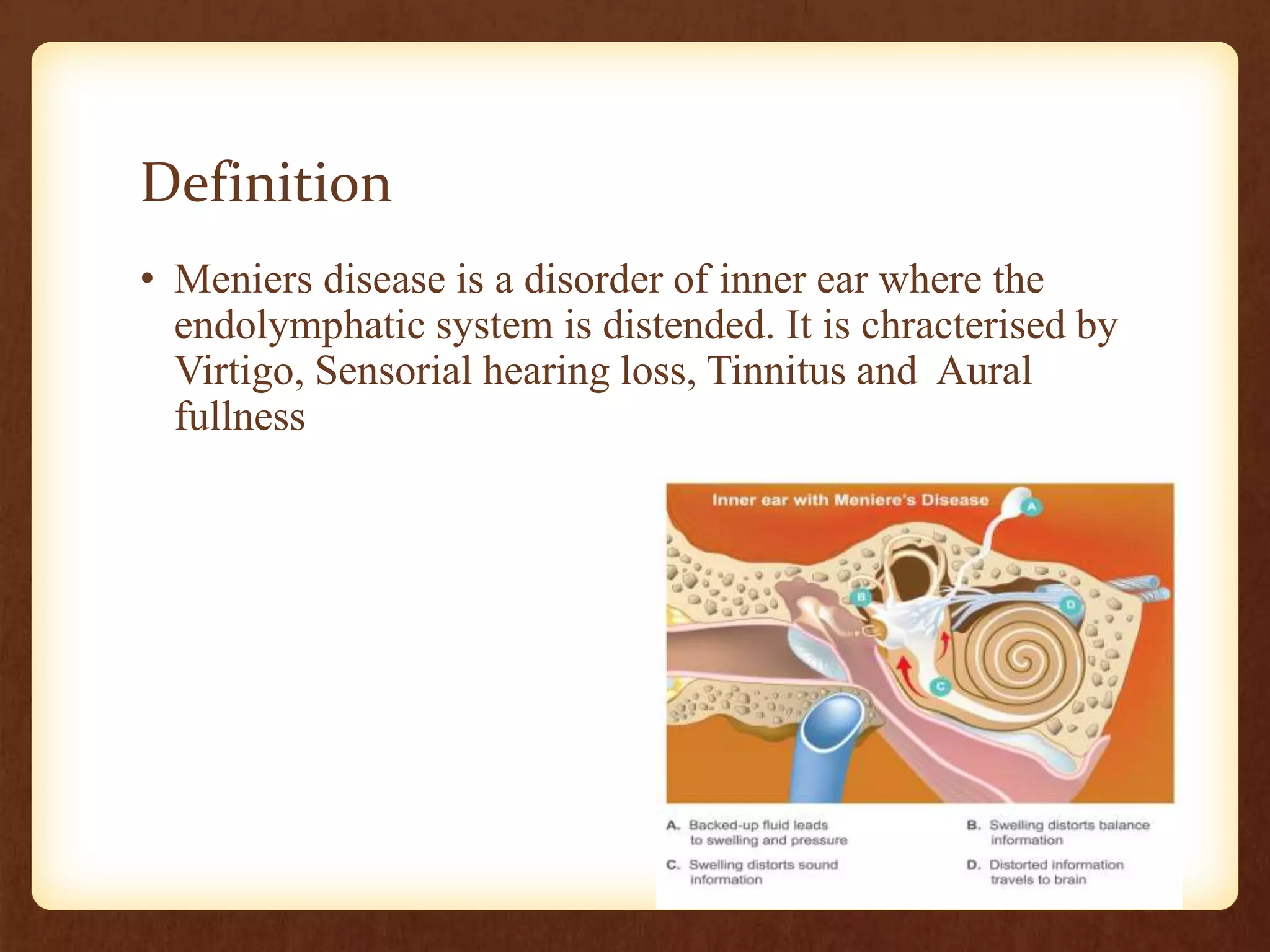 Meniere's disease | PPTX