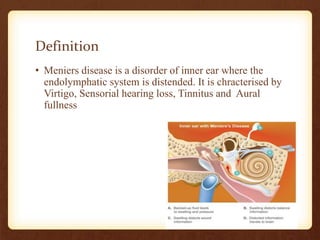 Meniere's disease | PPTX