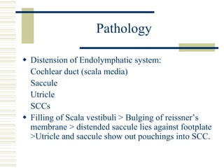 Meniere’s Disease.ppt