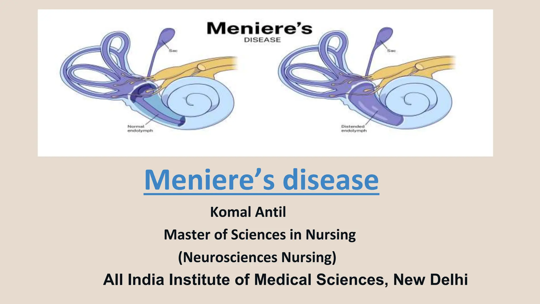 Ménière’s disease (Inner ear disease).pptx