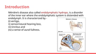 Méniere’s disease.pptx- definition, causes etc | PPTX