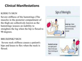 Menigitis final.ppt medical surgical nursing | PPT