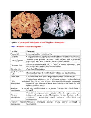 Topic of the month: Radiological pathology of meningiomas | PDF