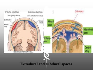 Meninges | PPT