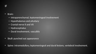 Comprehensive Overview of Meninges and Meningeal Lesions: Diagnosis and ...