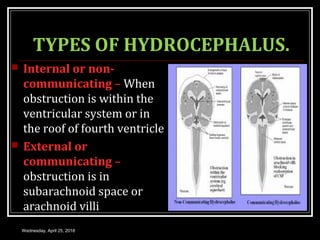 MENINGES, CEREBROSPINAL FLUID AND BLOOD BRAIN BARRIER | PPT
