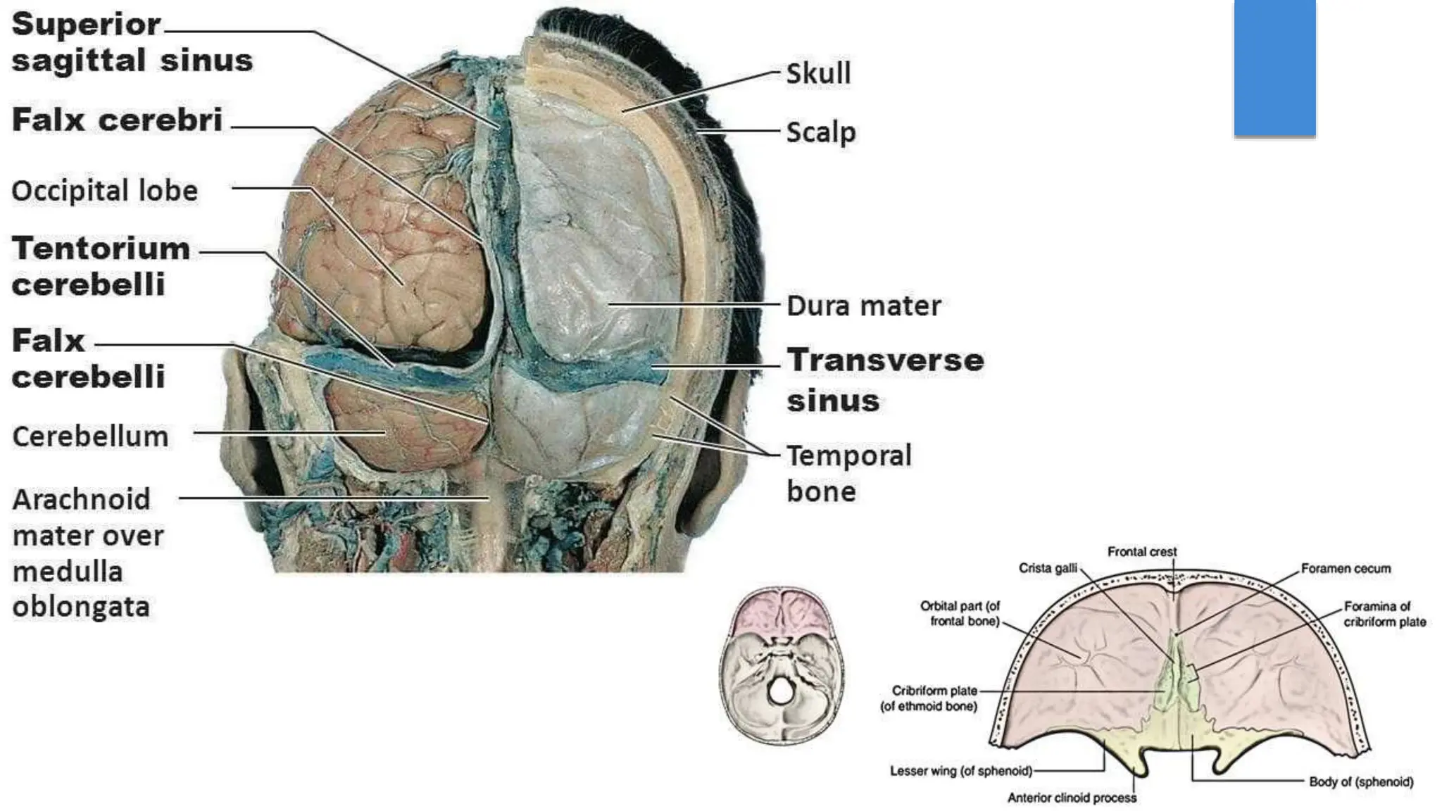 Meninges of Brain & Spinal Cord AnD Dura Venous Sinuses .pptx
