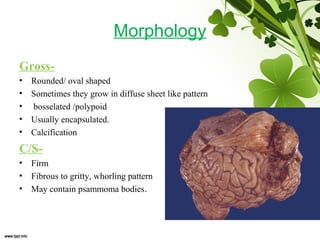 Meningioma | PPT