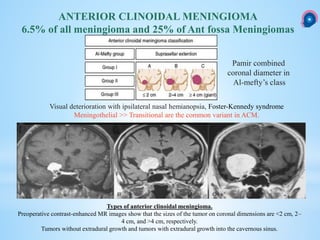 Meningioma of brain | PPTX