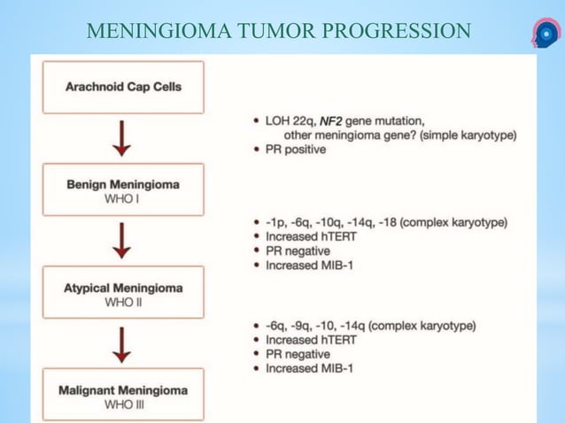 Meningioma of brain | PPTX