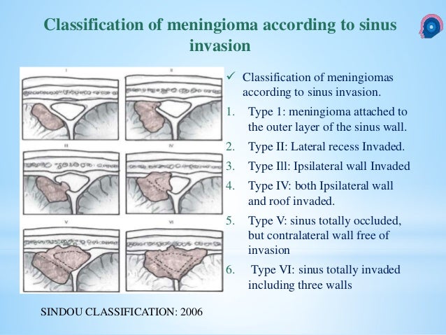 Meningioma of brain