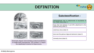 Meningiomas of the Middle Fossa Floor.pptx