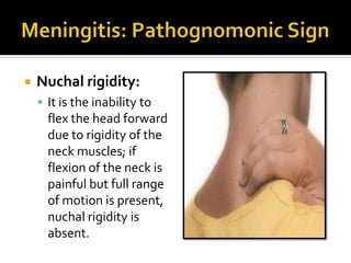 Meningitis and Encephalitis | PPTX