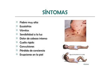 Meningitis | PPT