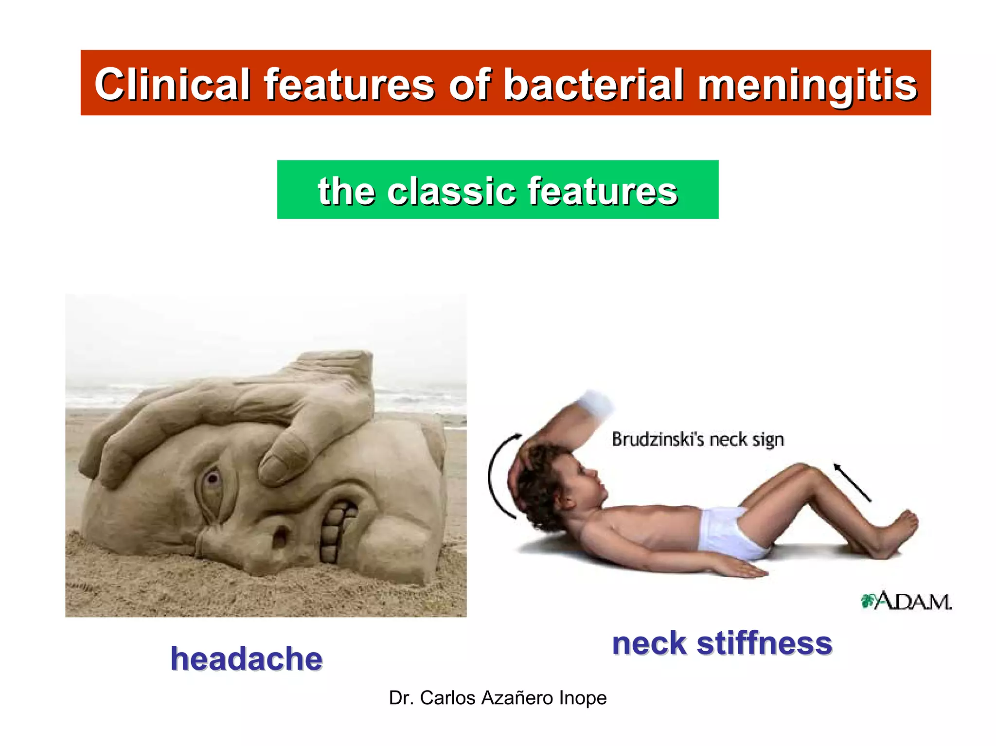 Meningitis | PDF
