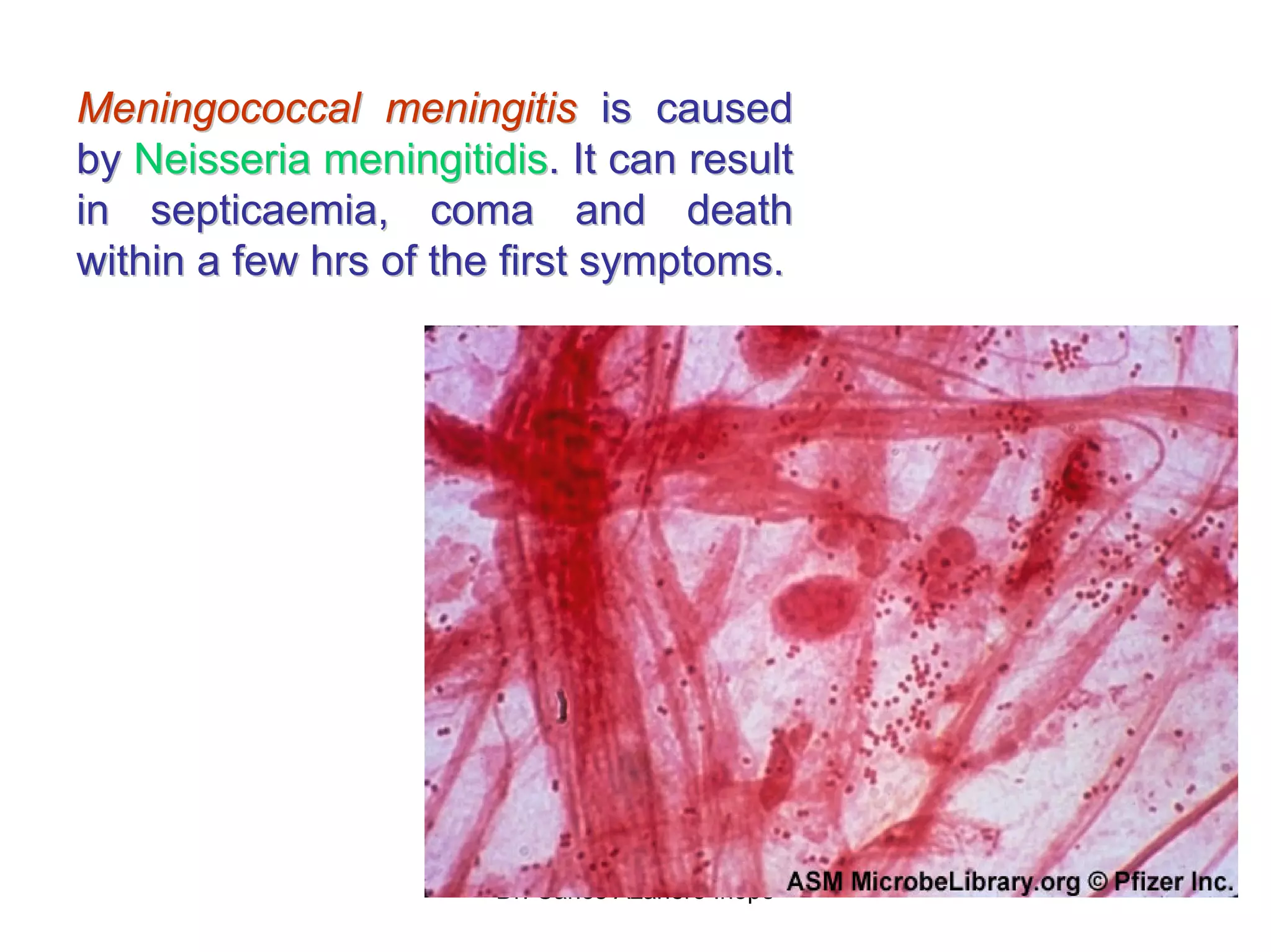 Meningitis | PDF