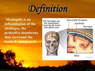 Meningitis | PPTX