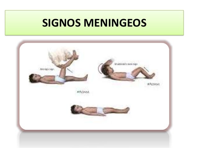 Meningitis