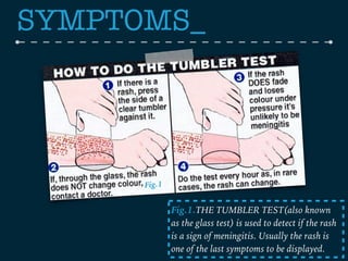Meningitis | PDF