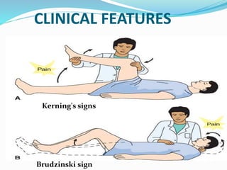 meningitis-170320103315.pdf
