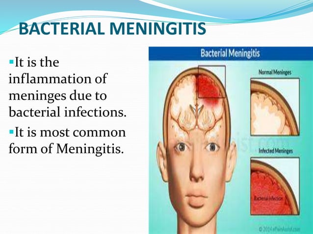 Meningitis | PPTX | Brain and Nervous System Disorders | Diseases and ...