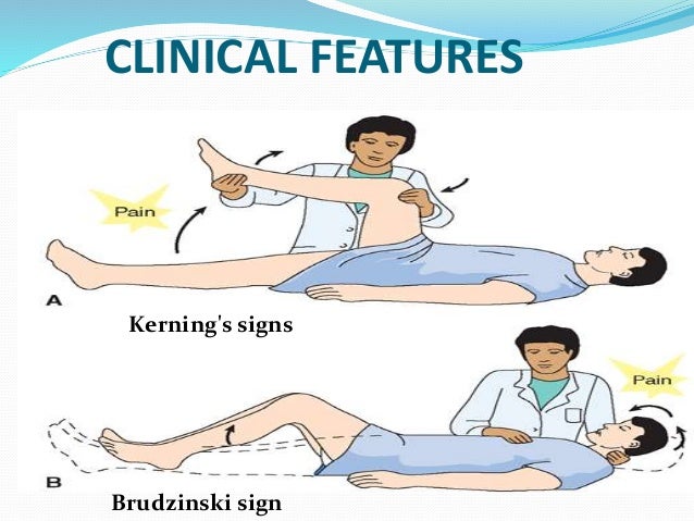 Meningitis