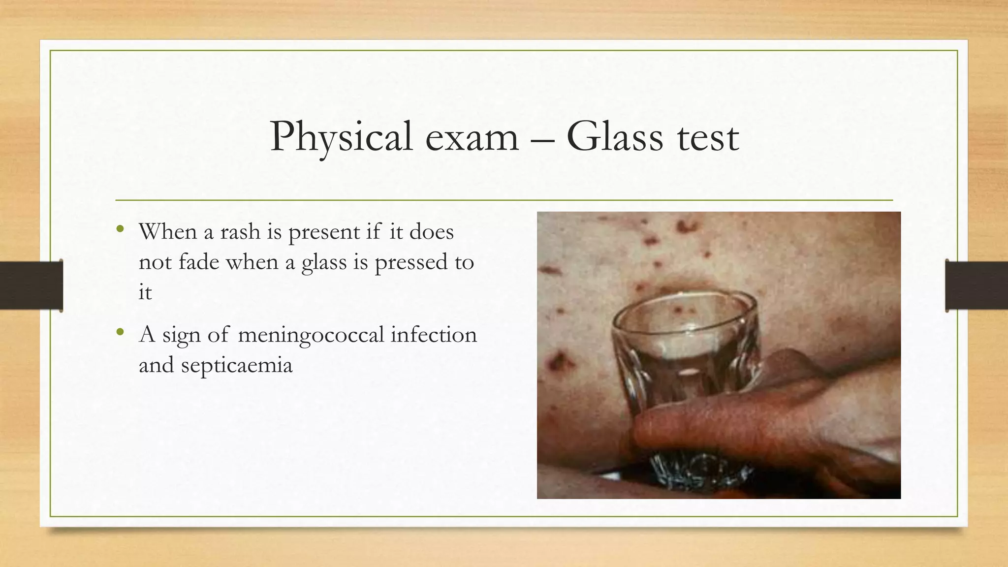 Meningitis | PPTX