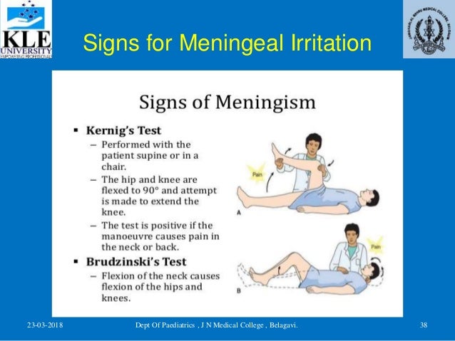 Meningitis ( Introduction , classification , Pathophysiology , clinic…