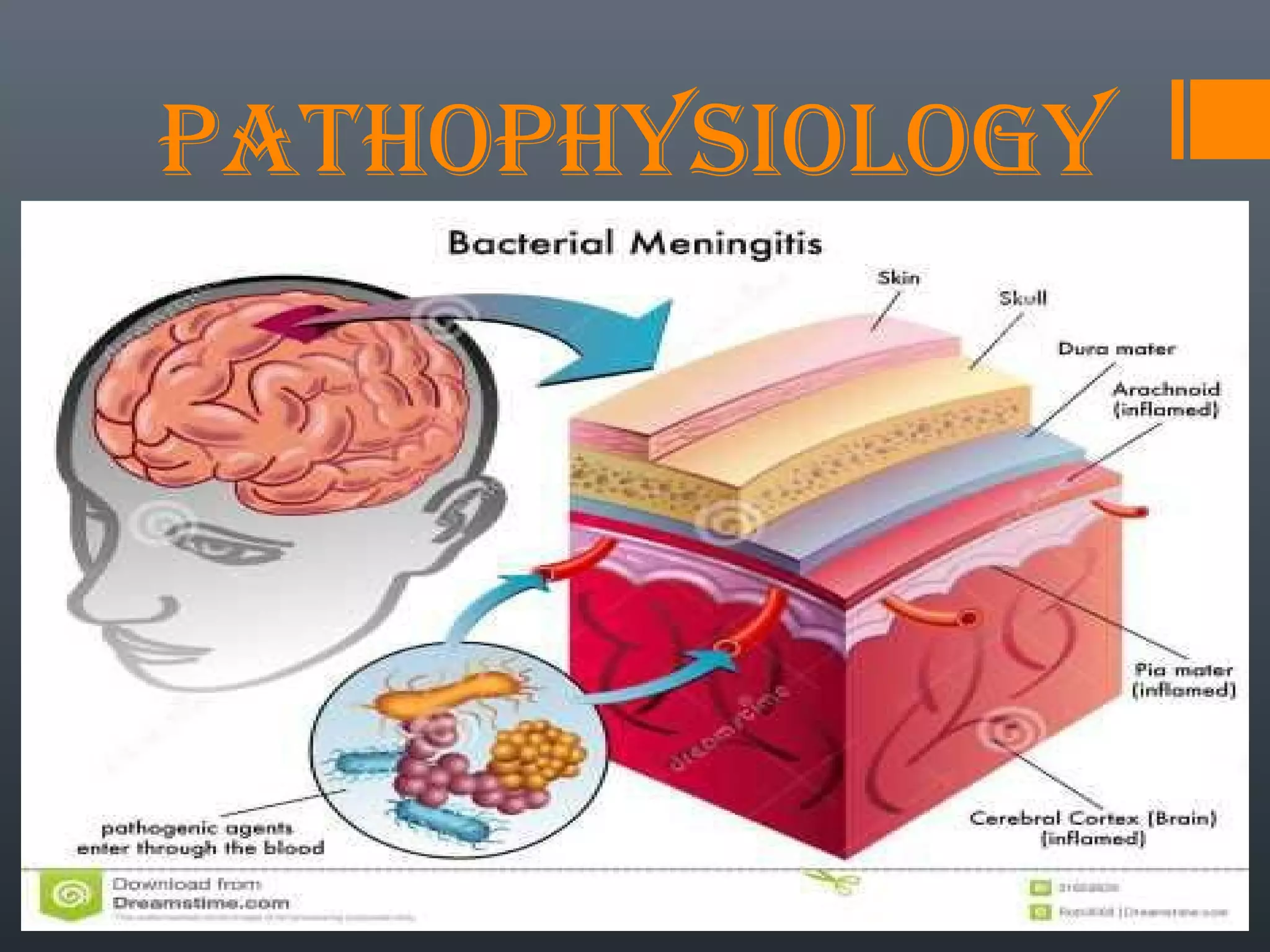 Meningitis | PPT | Infectious Diseases | Diseases and Conditions