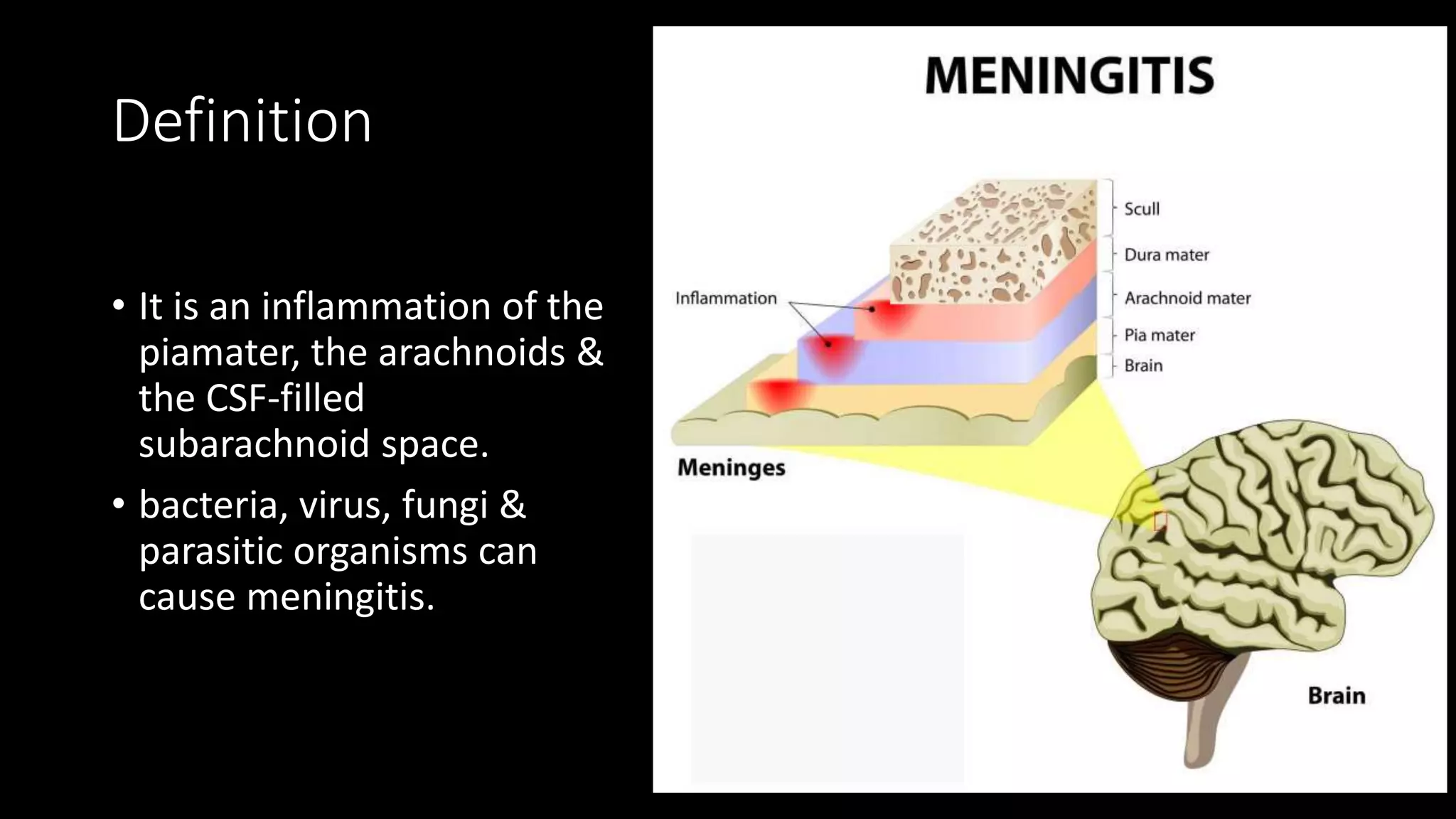 Meningitis | PPTX
