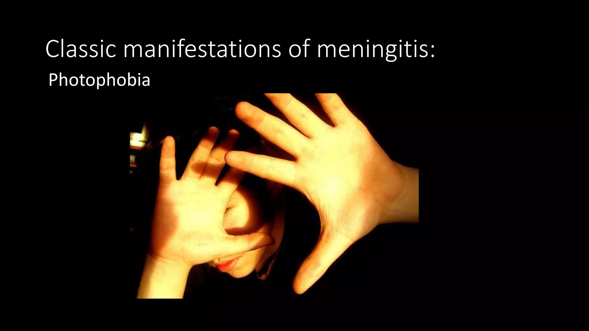 Meningitis | PPTX