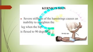 Meningitis | PPT