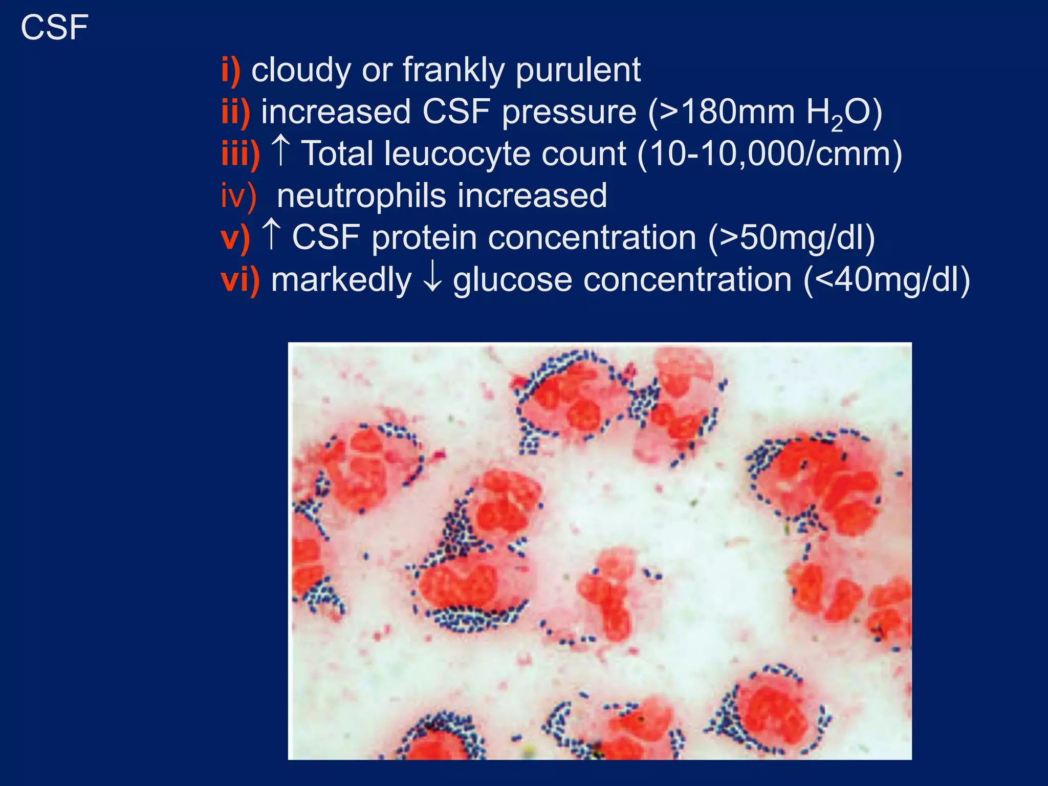 Meningitis | PPT