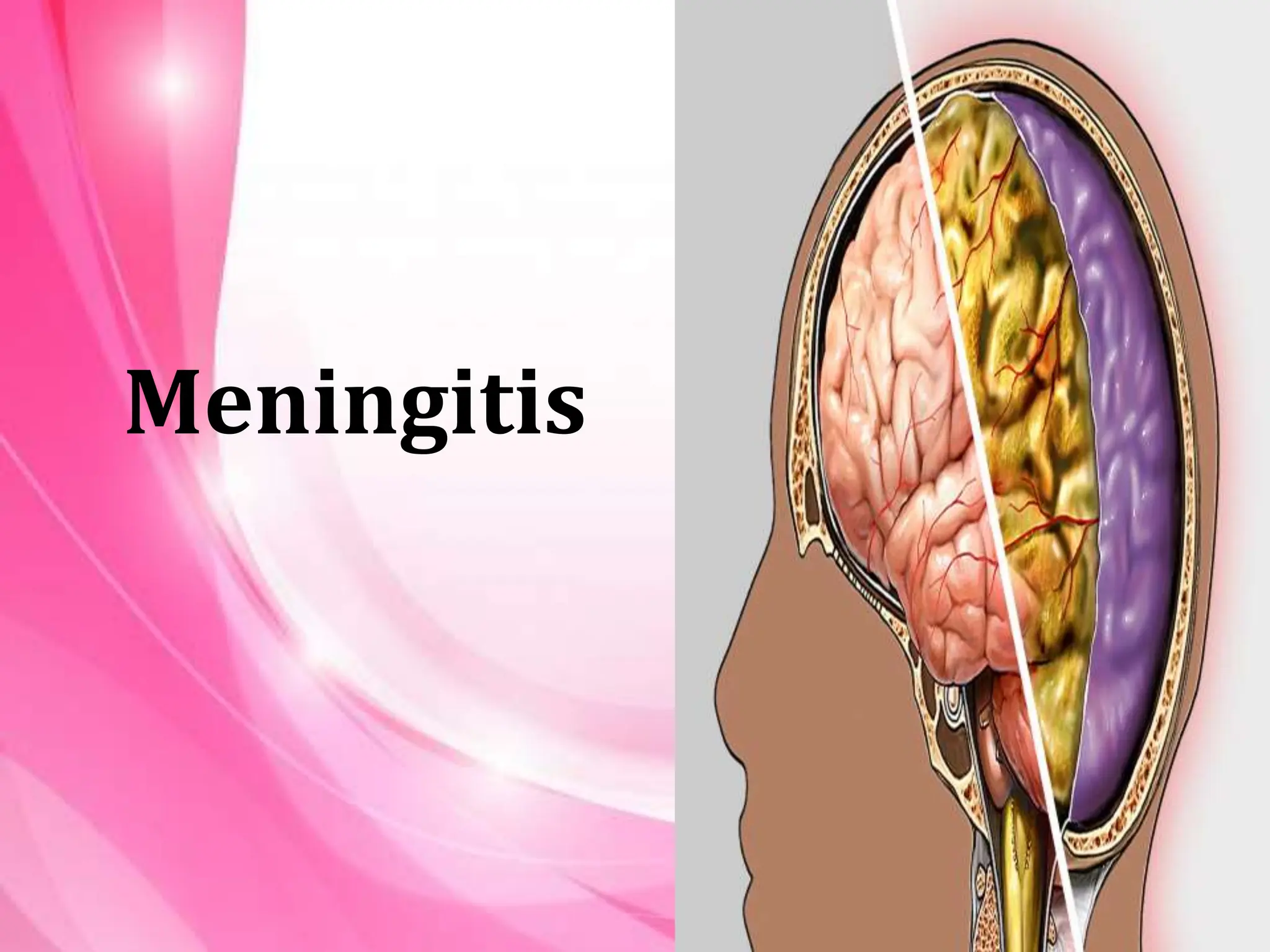 meningitis- medical surgicalnursing .pdf