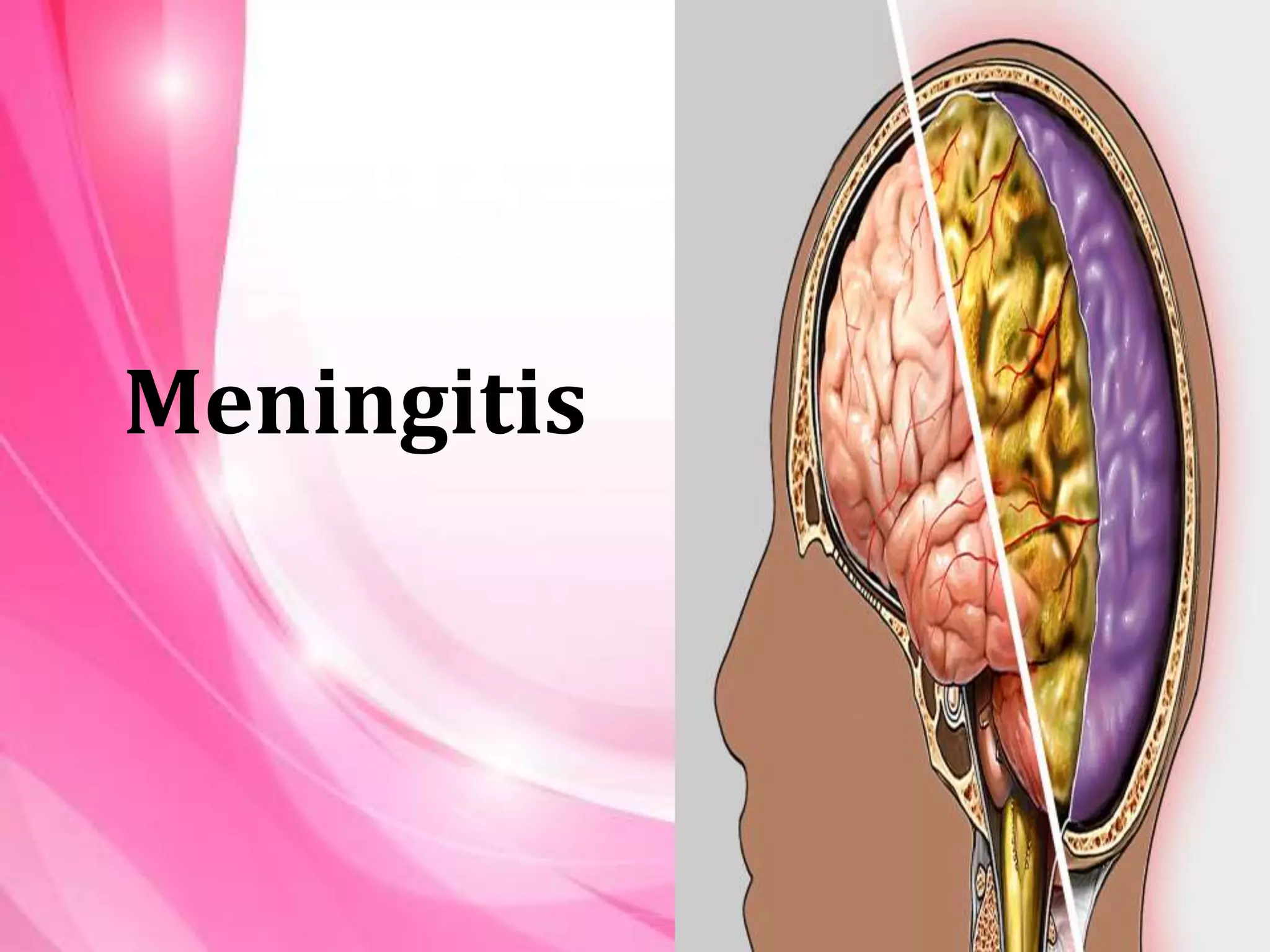 Meningitis | PPTX