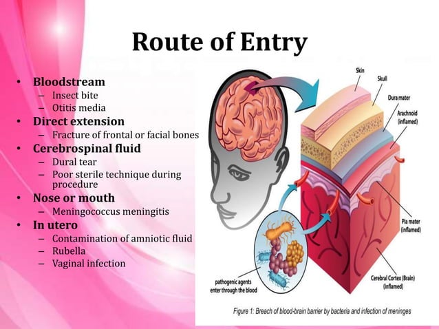 Meningitis | PPTX | Brain and Nervous System Disorders | Diseases and ...