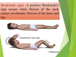 Meningitis in children | PPTX