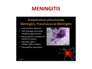Meningitis | PPTX