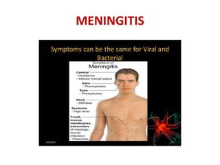 Meningitis | PPTX