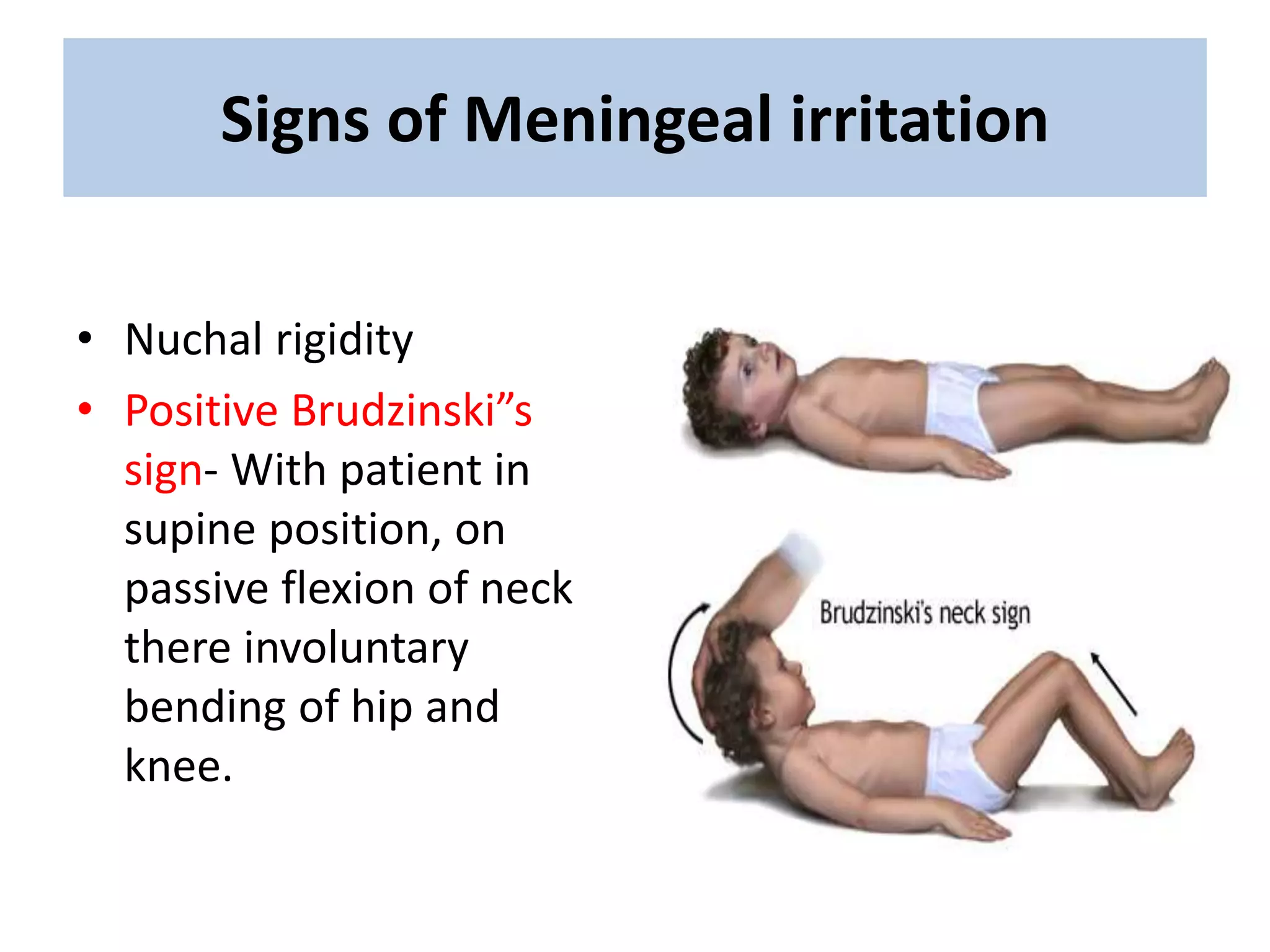 MENINGITIS.pptx