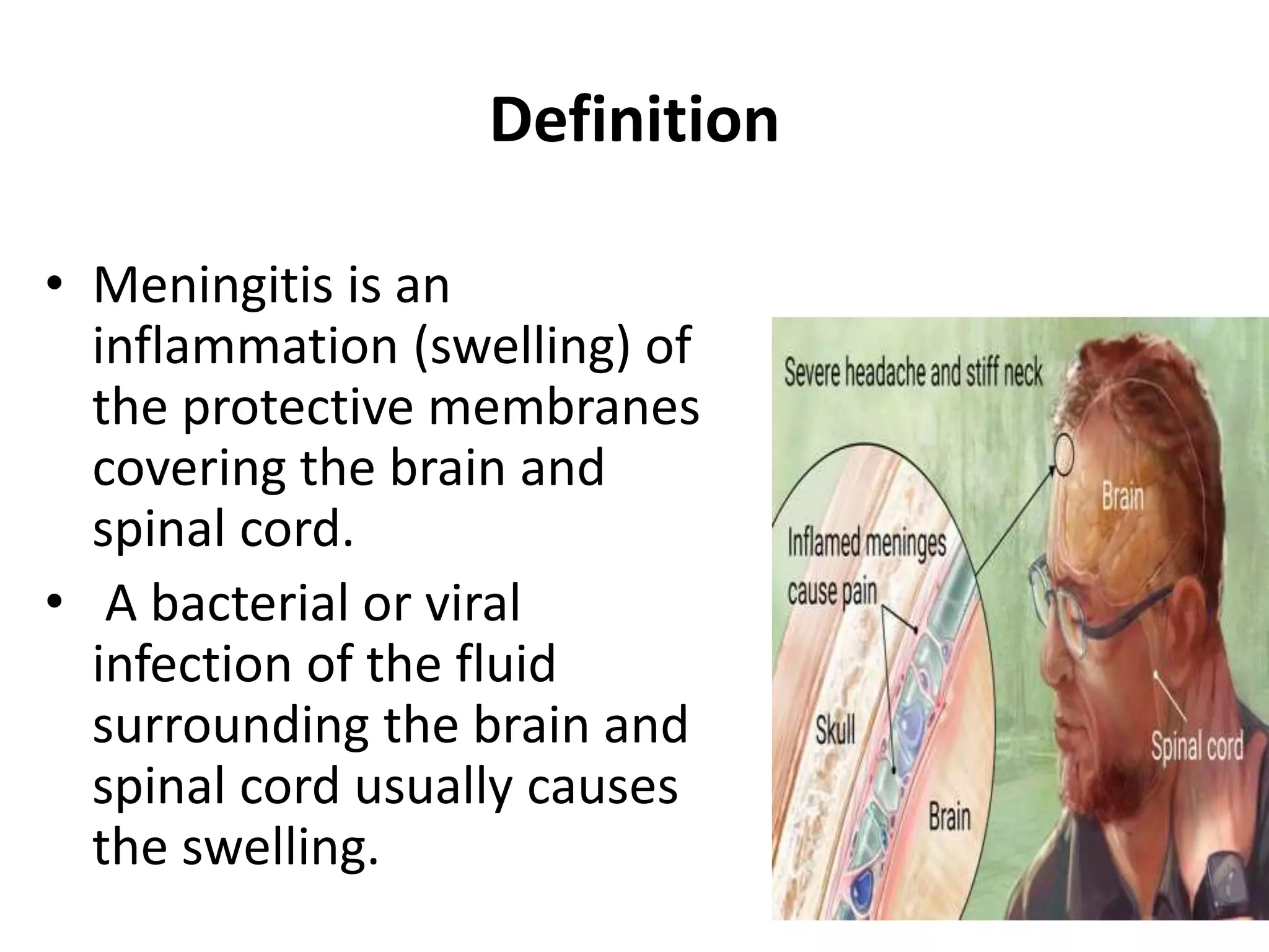 MENINGITIS.pptx