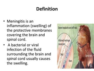 MENINGITIS.pptx