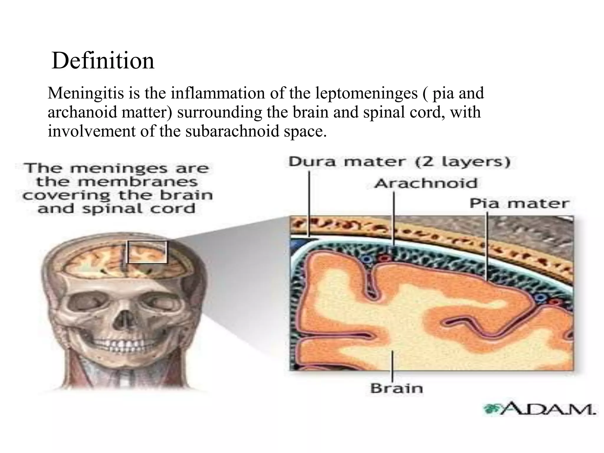 Meningitis | PPTX