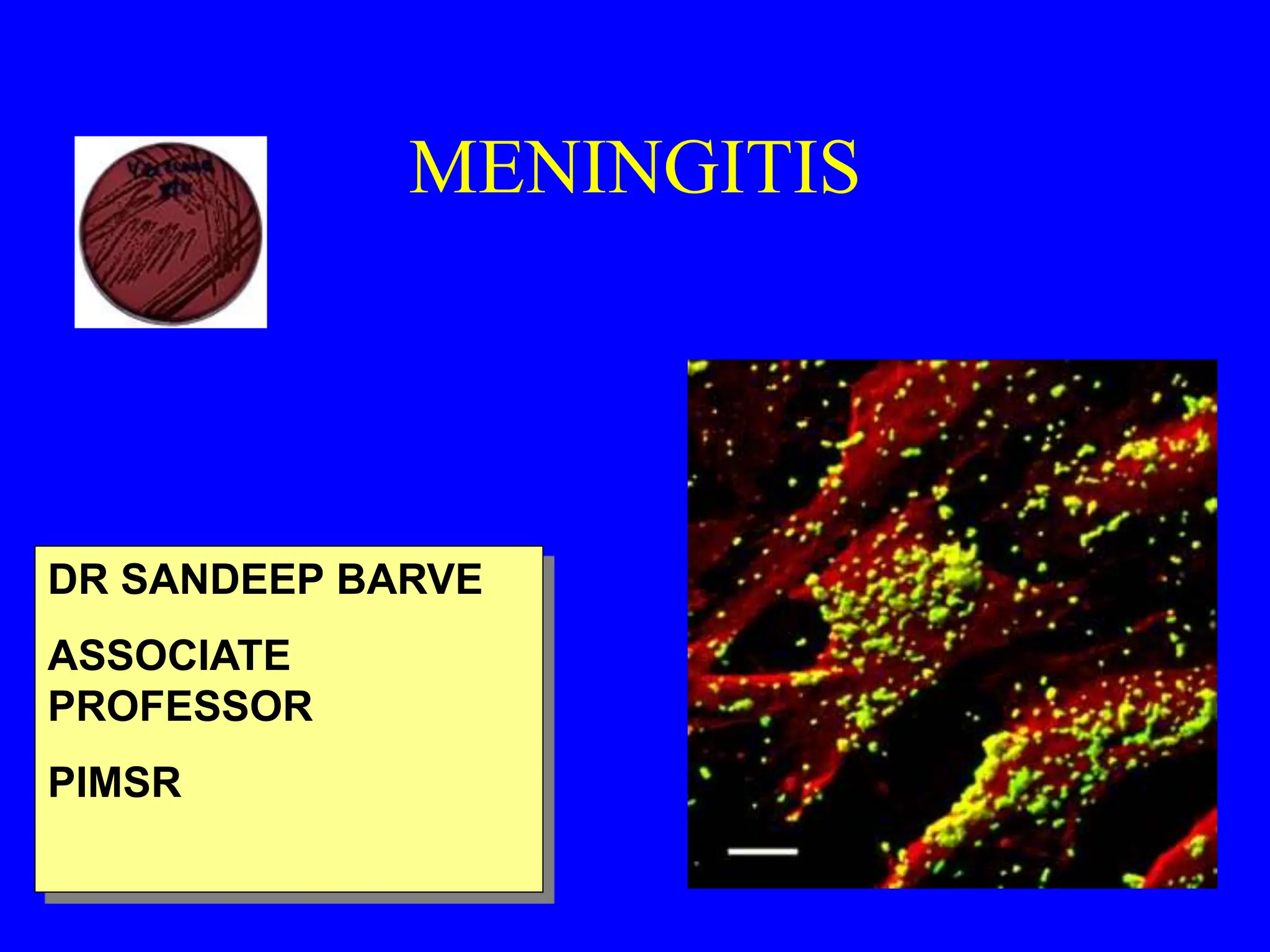 Meningitis.ppt