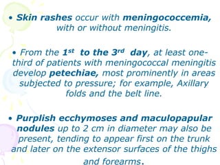 MENINGITIS.pptx hbhbbhnsdvjjjhhvdssxvhuhhhh | PPT