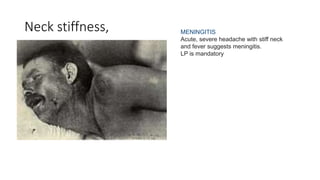 Introduction to Meningitis for Medical Students | PPTX