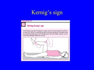 meningitis meruoakan penyakit menular yang harus di waspadai | PPT