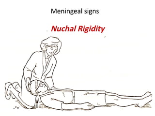 pengetahuan umum mengenai menginitis.pptx