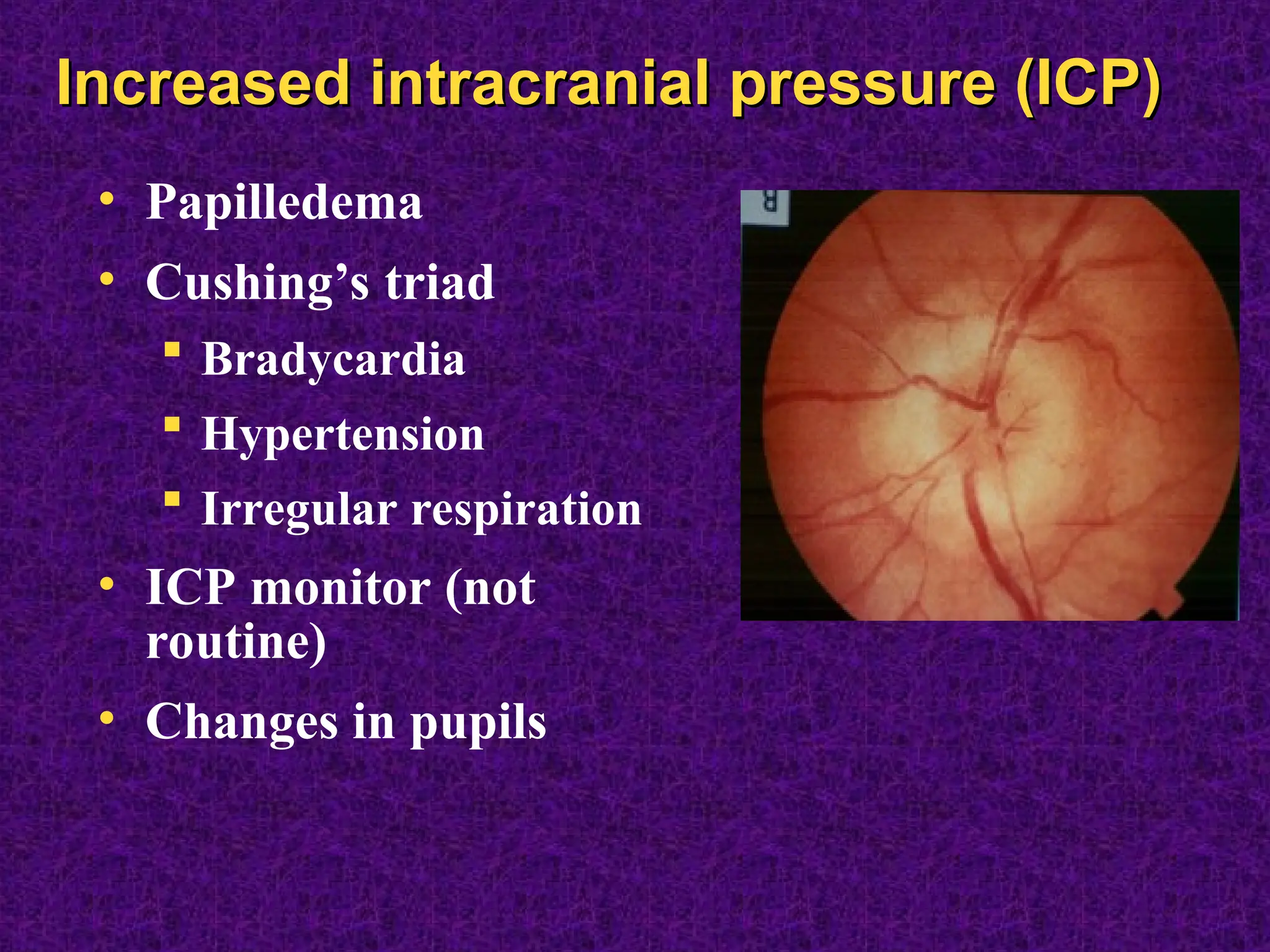 Meningitis.ppt contains information on meningitis | PPT
